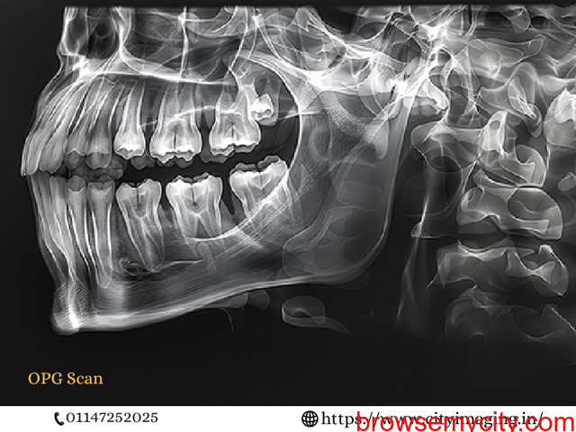 OPG X-Ray Cost Pricing, Factors & Affordable Options01147252025 - 368272